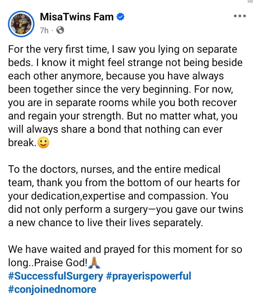 Saudi Arabia separates Filipino twins in one of world’s most complex ...